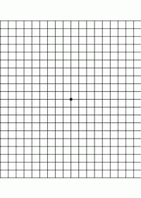 amsler-grid - The Eye Center